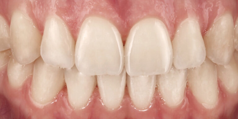 Ormco - Producten en Cursussen voor Orthodontisten