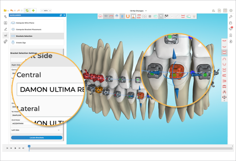 Ormco digitale hechting - Eén portal om cases in te dienen